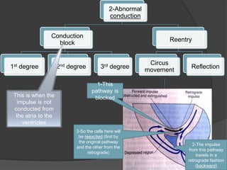 Antiarrhythmic_drugs | PPT