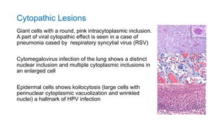 Inflammatory response to infection | PPTX