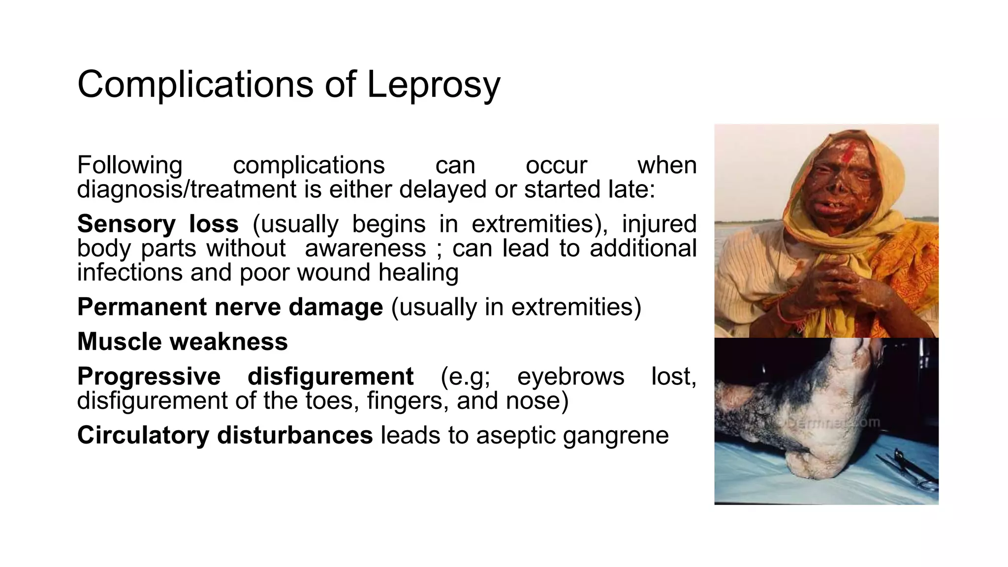 Tuberculosis & Leprosy | PPTX