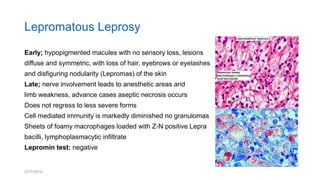 Tuberculosis & Leprosy | PPTX