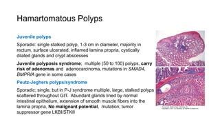 Intestinal neoplasm | PPTX