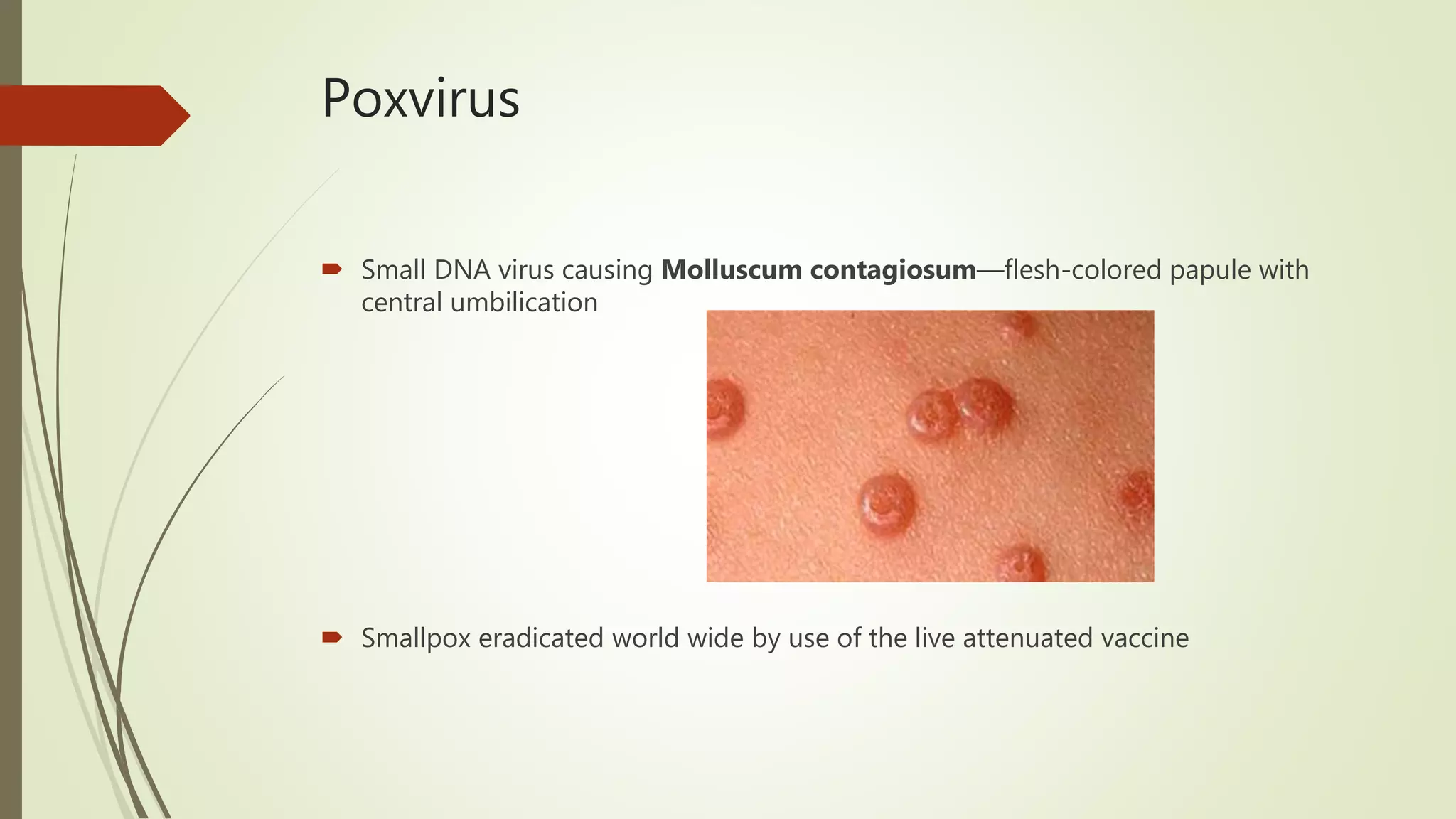 Lec4 measles, mumps, rubella, small pox & ulcer | PPT