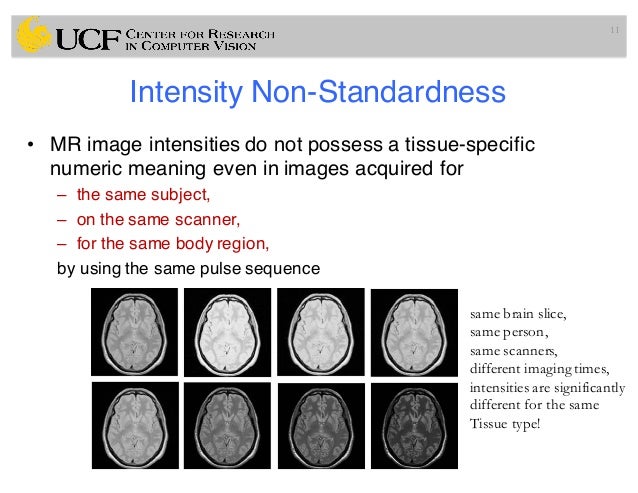 Lec5: Pre-Processing Medical Images (III) (MRI Intensity Standardizat…