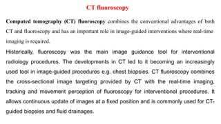 CT fluoroscopy | PDF