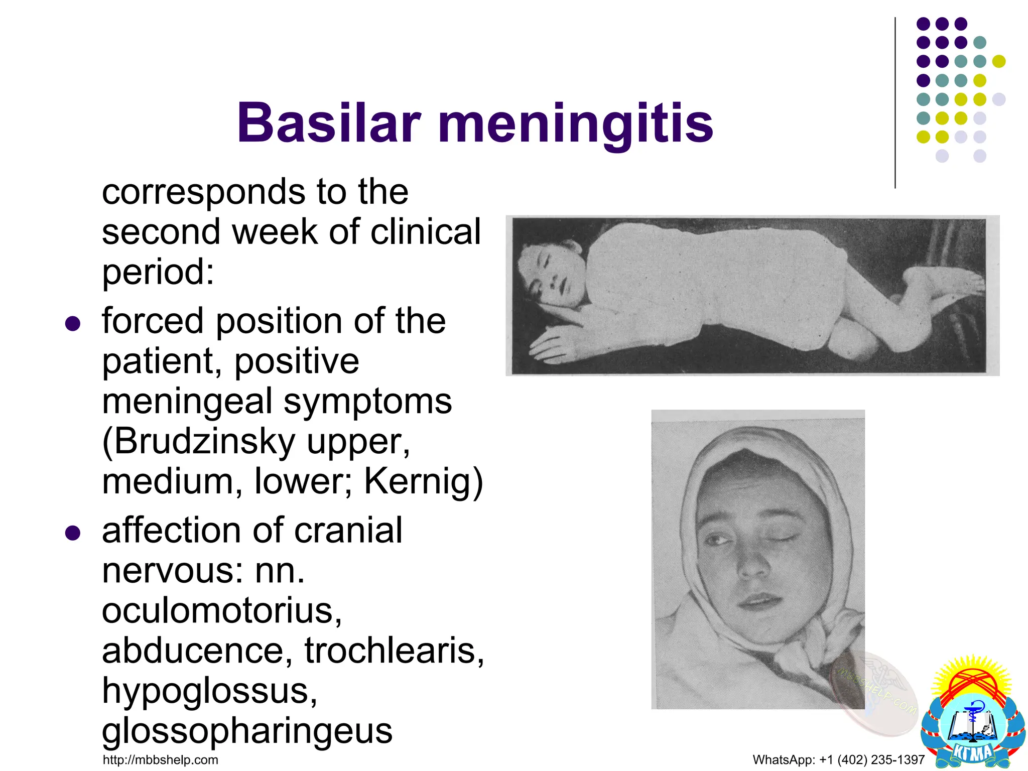 Lec 5.pdf tuberculosis miliary tuberculosis meningitis | PDF