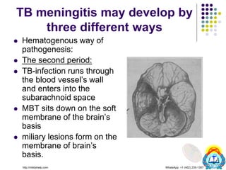 Lec 5.pdf tuberculosis miliary tuberculosis meningitis | PDF