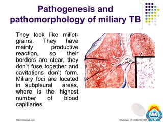 Lec 5.pdf tuberculosis miliary tuberculosis meningitis | PPT