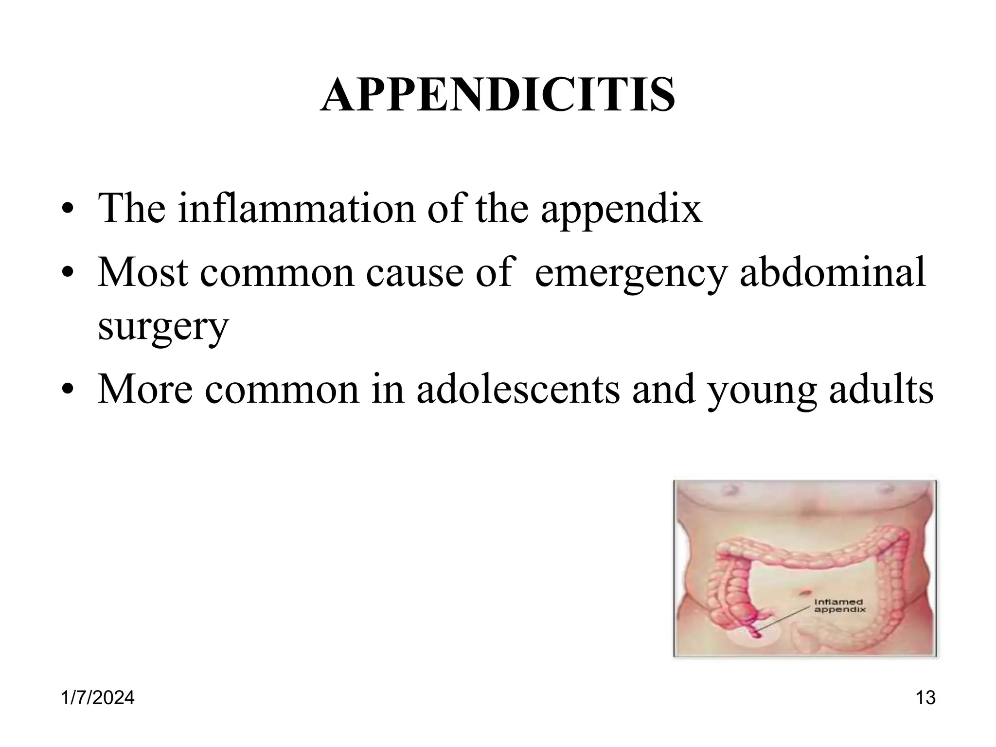 Lec # 5 Disorders of small & large Intestine.ppt