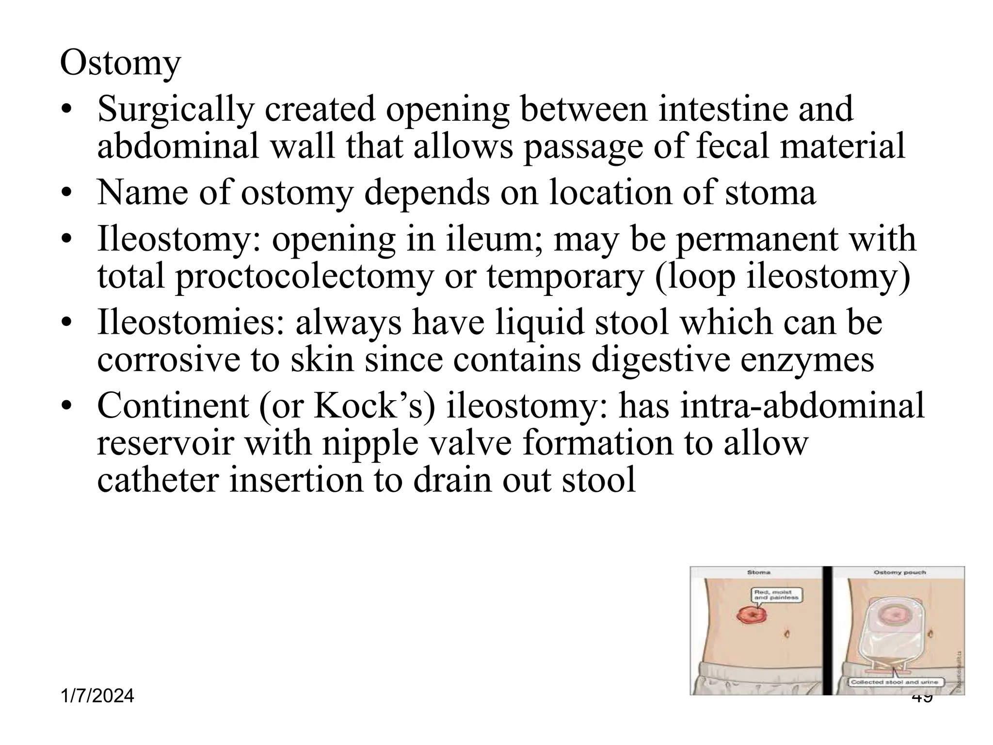 Lec # 5 Disorders of small & large Intestine.ppt