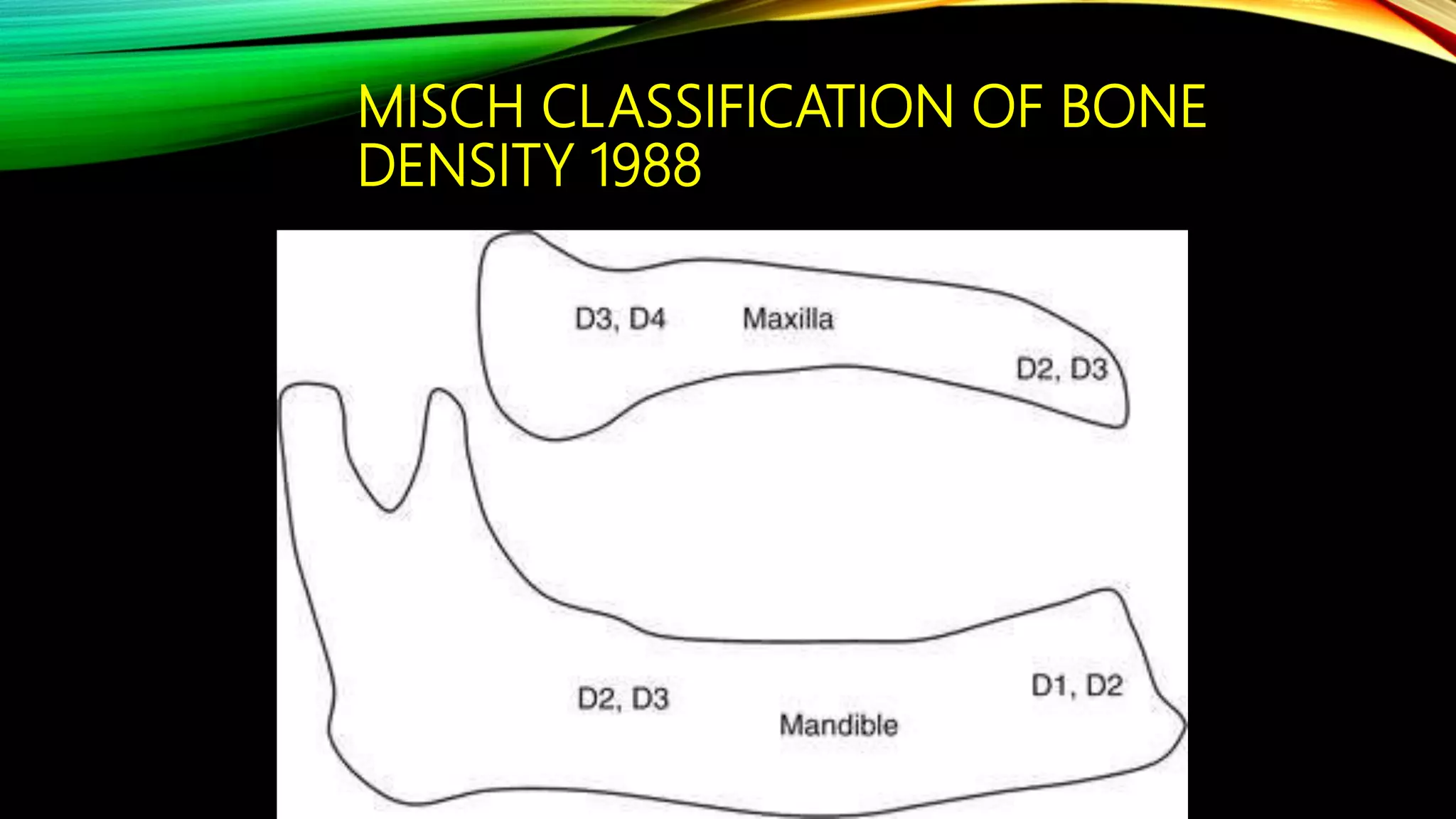 Lec 5 implant | PPTX