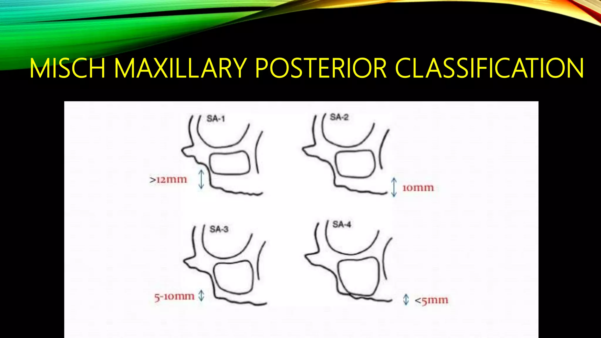 Lec 5 implant | PPTX