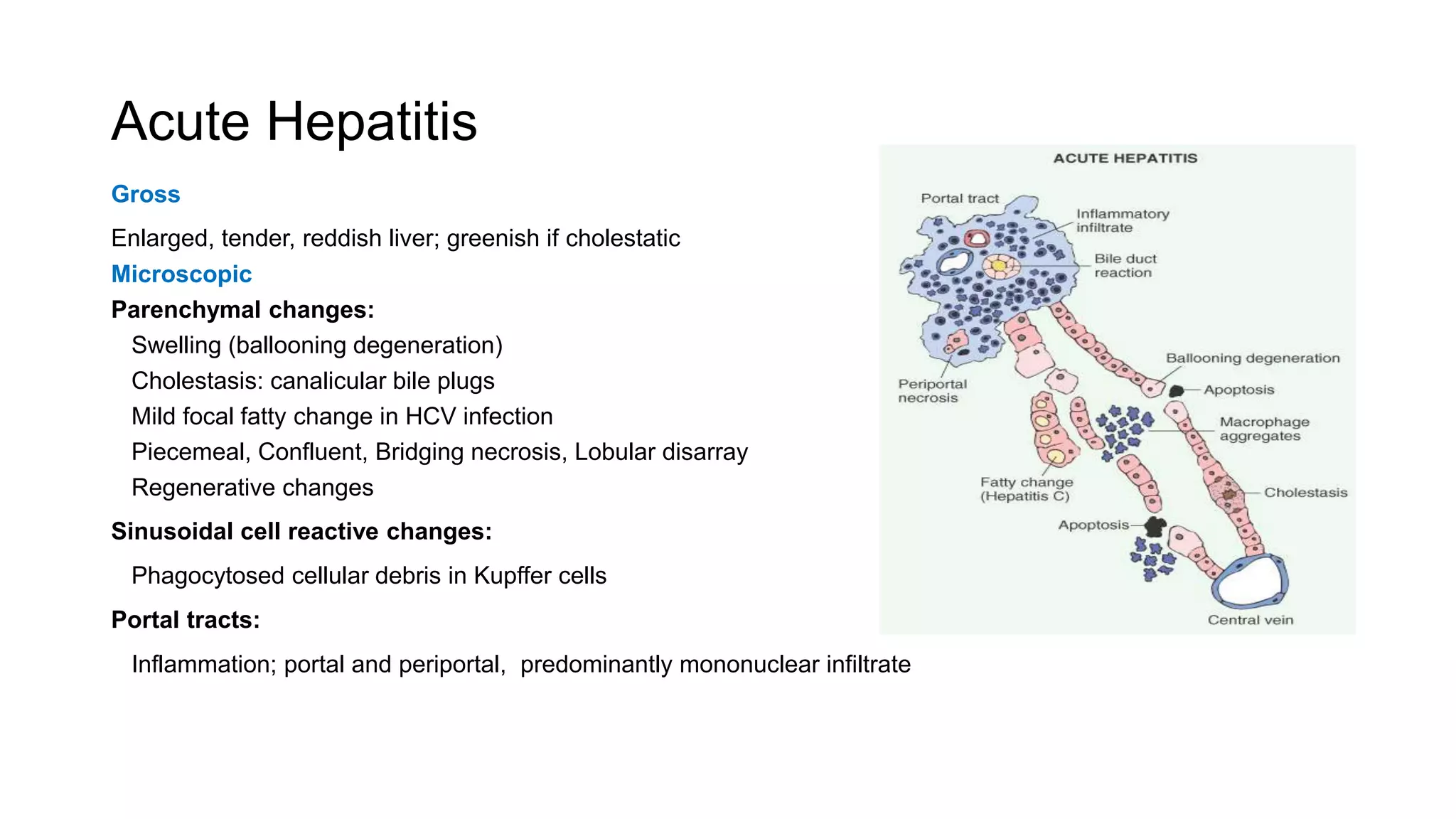 Inflammatory liver disease | PPTX