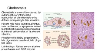 Inflammatory liver disease | PPTX