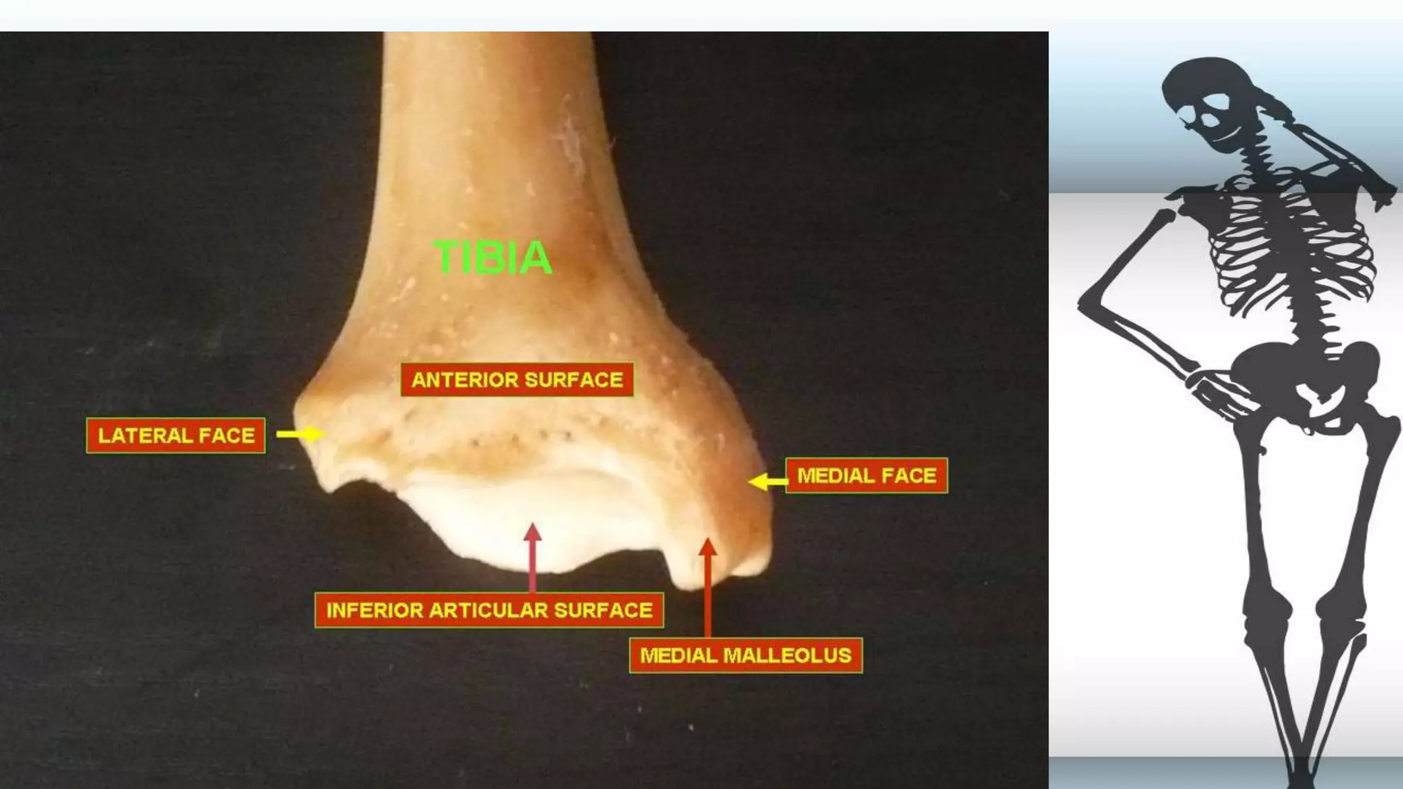 Lec 5 tibia bone | PPTX