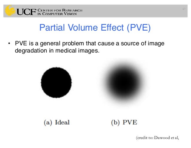 Lec6: Pre-Processing for Nuclear Medicine Images