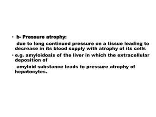 LEC 6 cellular adaptation.ppt | Endocrine and Metabolic Diseases ...