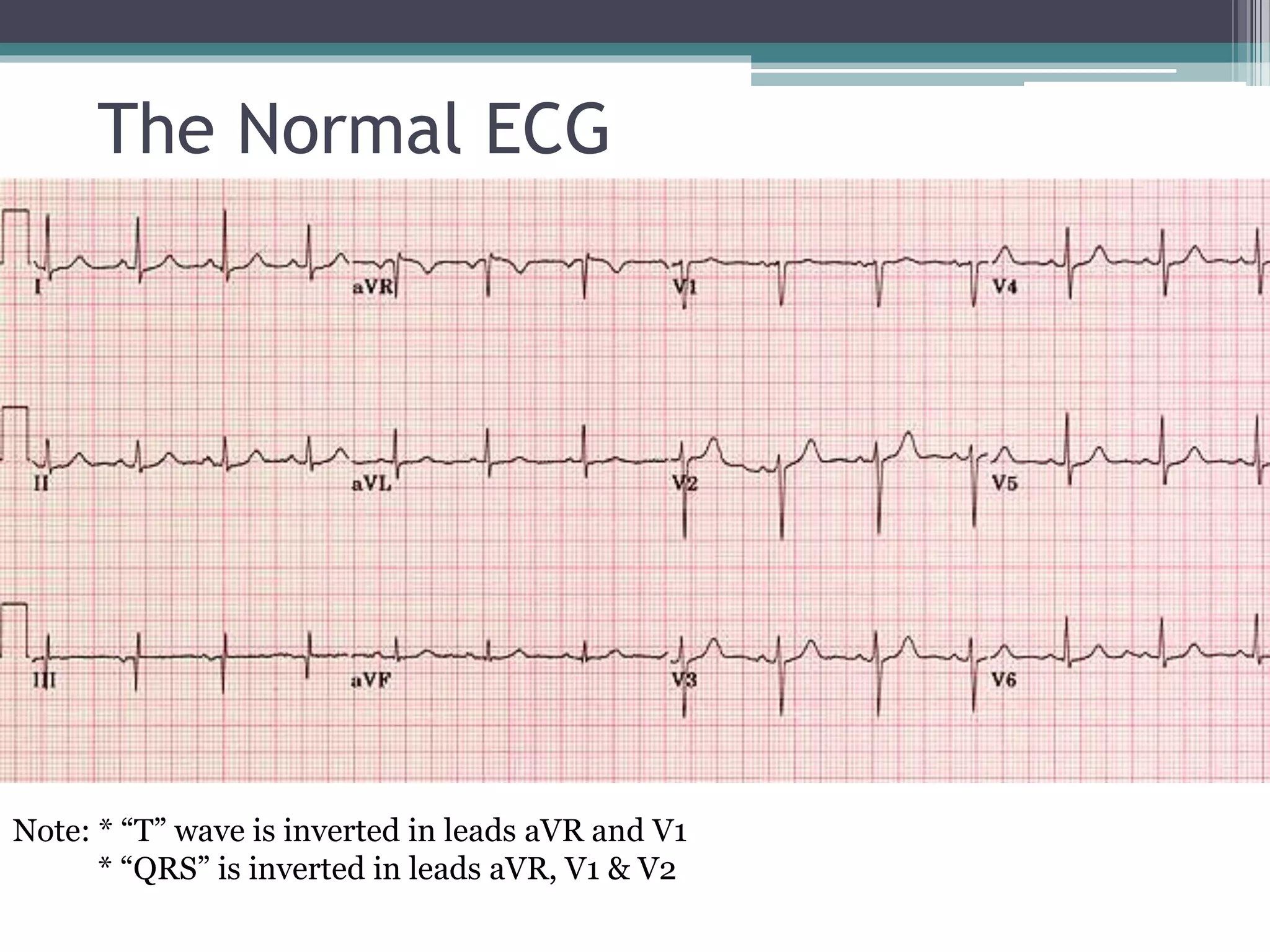 Lec 6 ECG.pptx