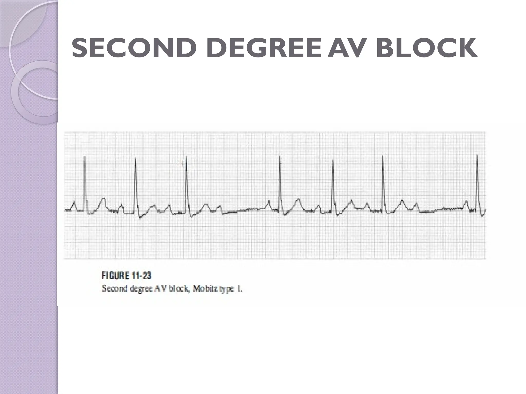 Lec 6 ECG.pptx cardiopulmonary physical therapy | PPTX