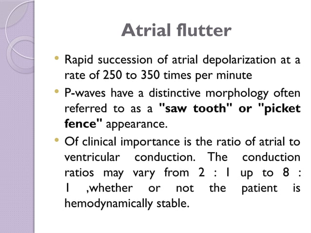 Lec 6 ECG.pptx cardiopulmonary physical therapy | PPT