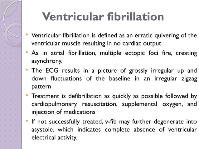 Lec 6 ECG.pptx cardiopulmonary physical therapy | PPT