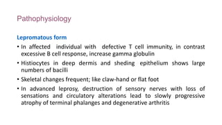 Lec 6 leprosy | PPT