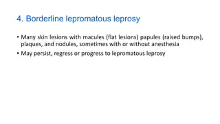 Lec 6 leprosy | PPT