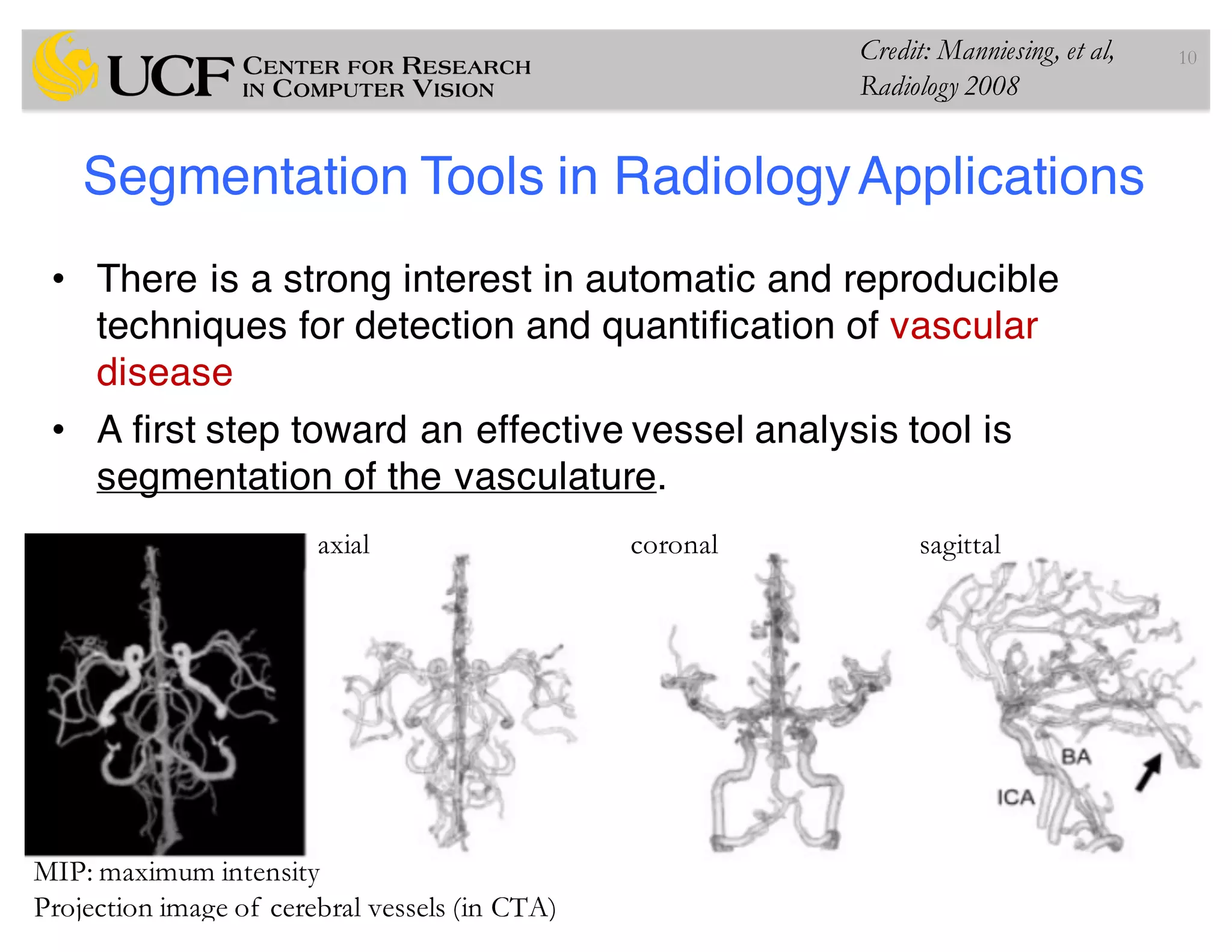 Lec7: Medical Image Segmentation (I) (Radiology Applications of Segmentation, and Thresholding ...