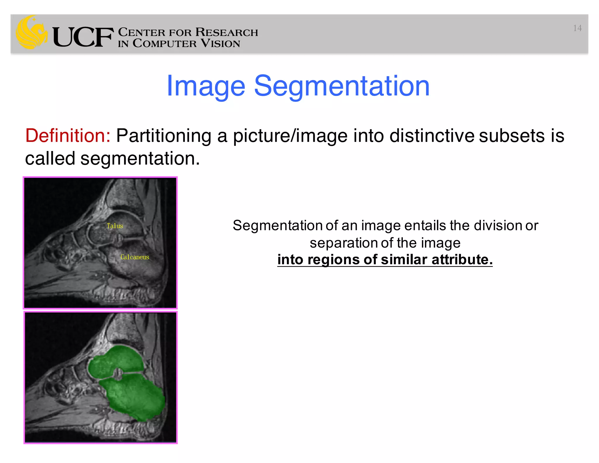 Lec7: Medical Image Segmentation (I) (Radiology Applications of ...