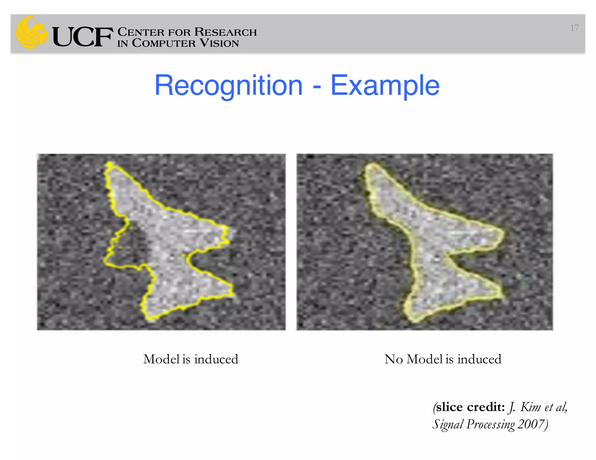 Lec7: Medical Image Segmentation (I) (Radiology Applications of Segmentation, and Thresholding ...