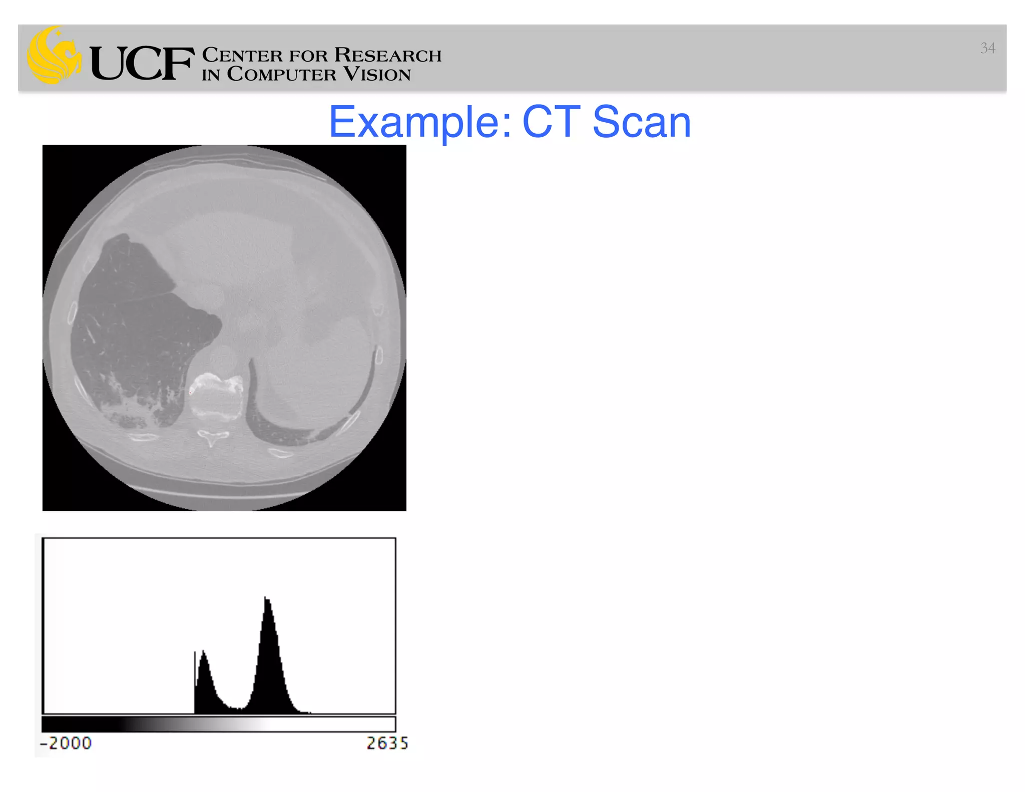 Lec7: Medical Image Segmentation (I) (Radiology Applications of ...