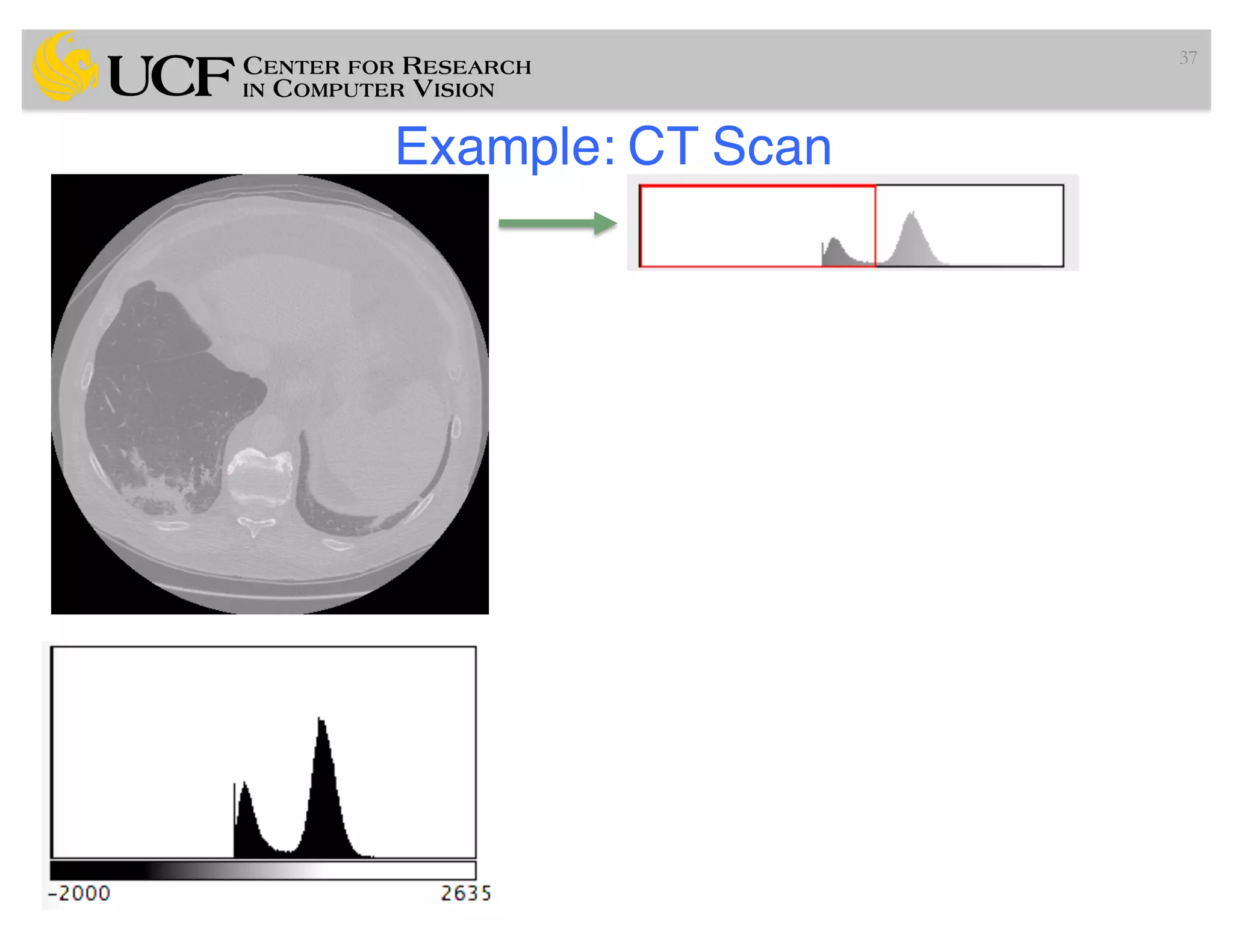 Lec7: Medical Image Segmentation (I) (Radiology Applications of ...