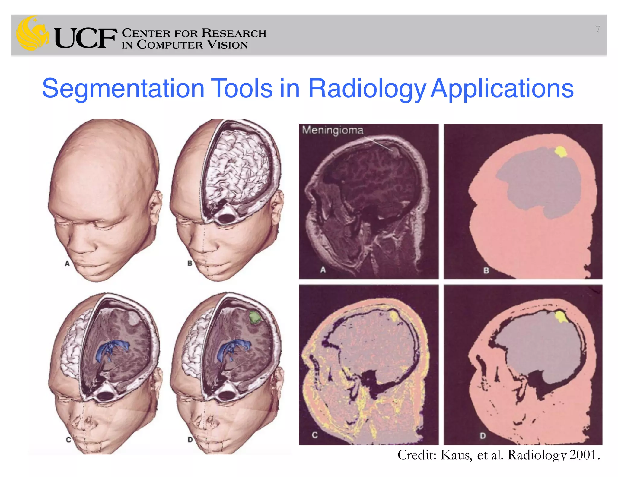 Lec7: Medical Image Segmentation (I) (Radiology Applications of ...