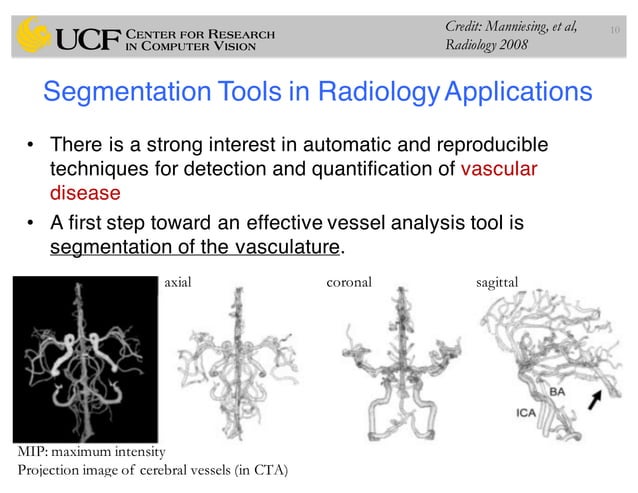 Lec7: Medical Image Segmentation (I) (Radiology Applications of ...