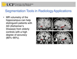 Lec7: Medical Image Segmentation (I) (Radiology Applications of ...