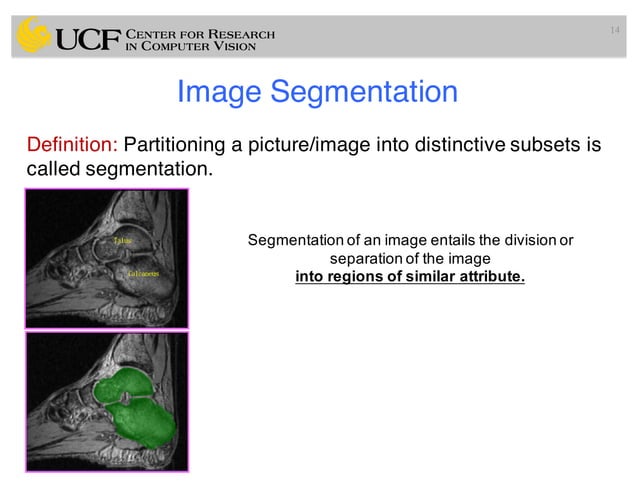 Lec7: Medical Image Segmentation (I) (Radiology Applications of Segmentation, and Thresholding ...