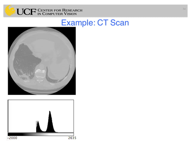 Lec7: Medical Image Segmentation (I) (Radiology Applications of ...