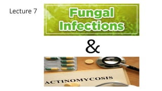 Lec 7 fungal infections | PPT