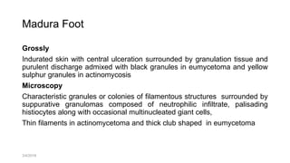 Lec 7 fungal infections | PPT