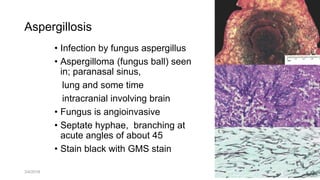 Lec 7 fungal infections | PPTX