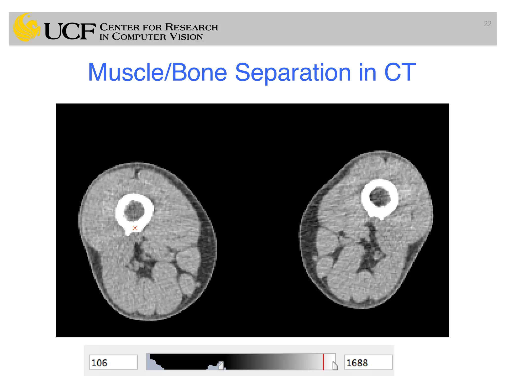 Lec8: Medical Image Segmentation (II) (Region Growing/Merging) | PPT