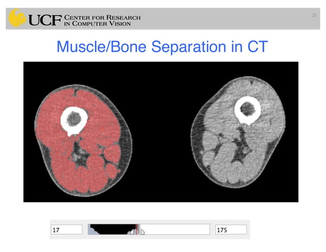 Lec8: Medical Image Segmentation (II) (Region Growing/Merging) | PPT