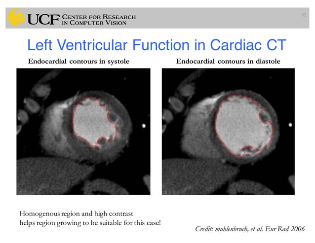 Lec8: Medical Image Segmentation (II) (Region Growing/Merging) | PPT
