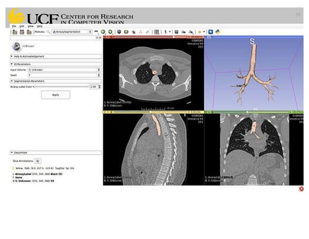 Lec8: Medical Image Segmentation (II) (Region Growing/Merging) | PPT
