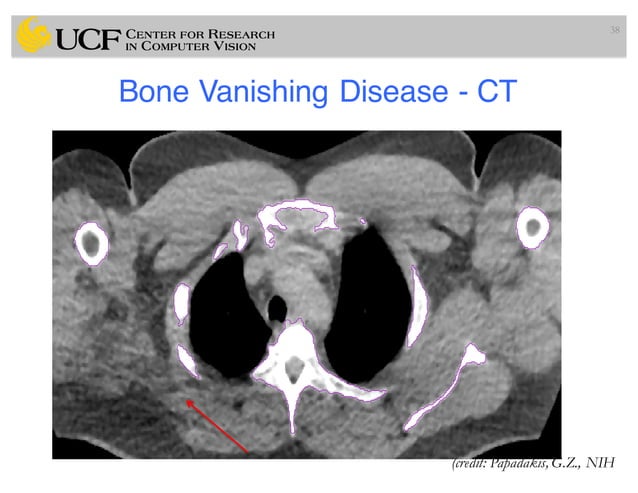 Lec8: Medical Image Segmentation (II) (Region Growing/Merging) | PPT