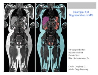 Lec8: Medical Image Segmentation (II) (Region Growing/Merging) | PPT