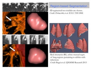 Lec8: Medical Image Segmentation (II) (Region Growing/Merging) | PPT
