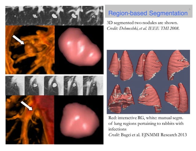 Lec8 Medical Image Segmentation Ii Region Growing Merging Ppt