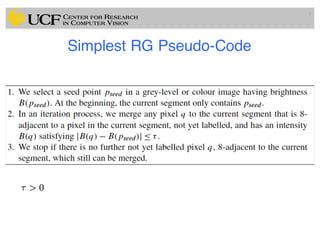Lec8: Medical Image Segmentation (II) (Region Growing/Merging) | PPT