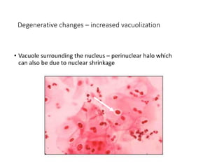 Lec8. Benign changes.2022.pdf
