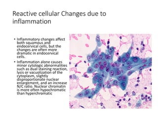 Lec8. Benign changes.2022.pdf